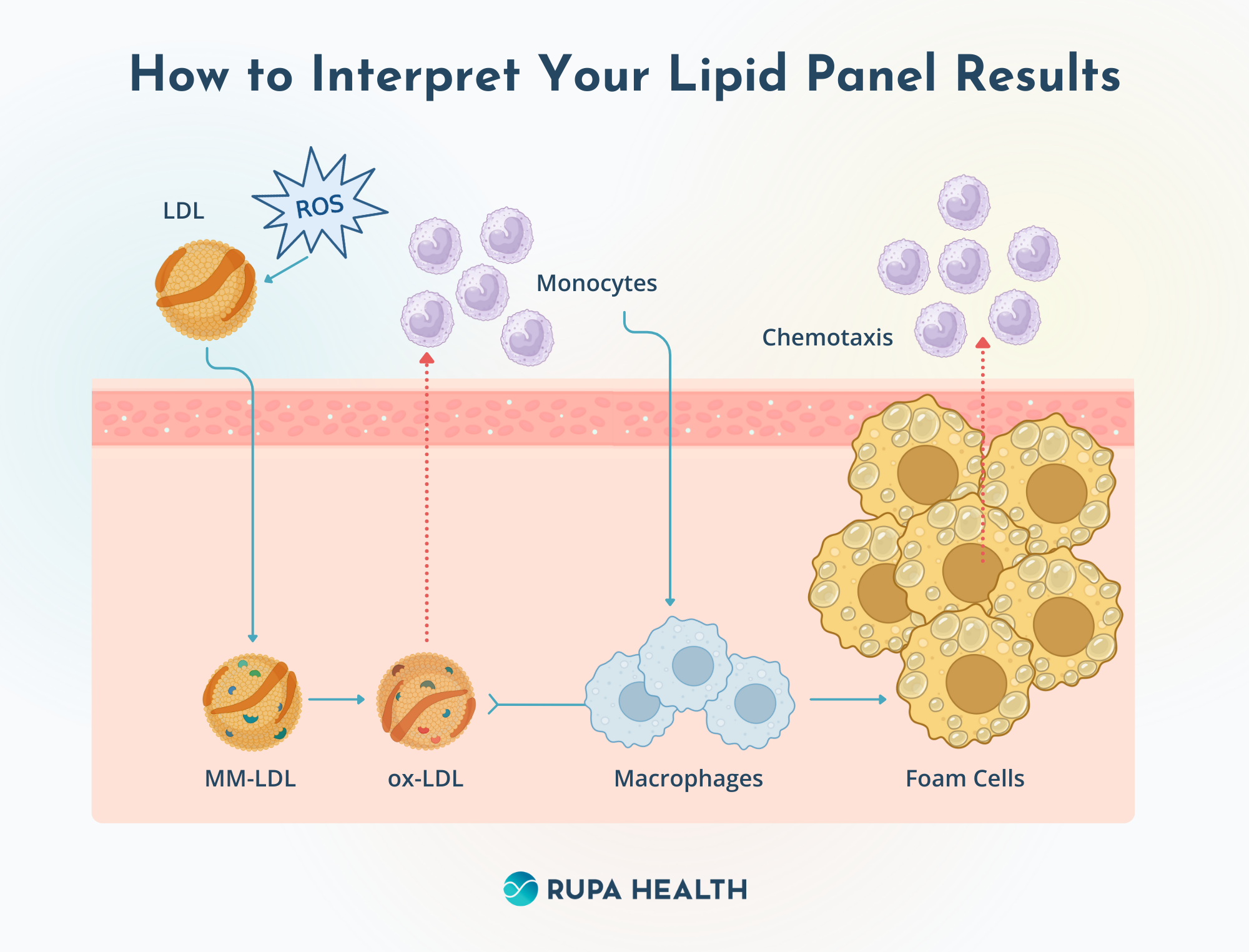 How To Interpret Your Lipid Panel Results